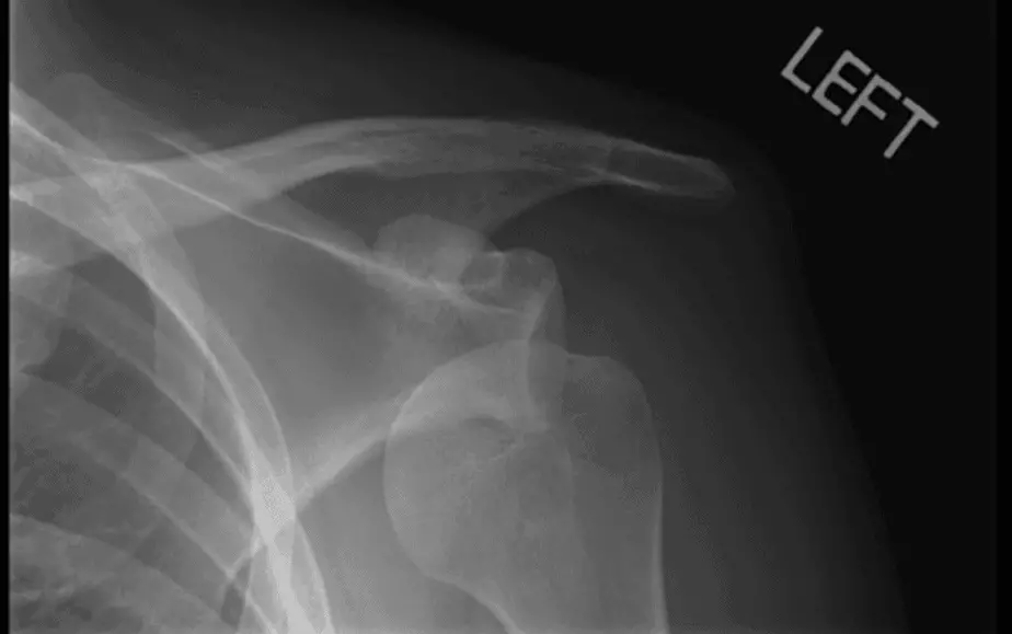 Ruck March Shoulder Pain - How to Avoid It | Ruck For Miles